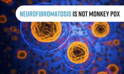 News - Not All ‘Bumps’ Are the Same – NF is not Monkeypox - Children's ...